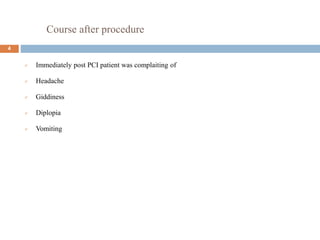 Stroke a rare complication in Post PCI patient | PPT