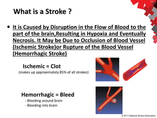 Stroke Awareness.pptx
