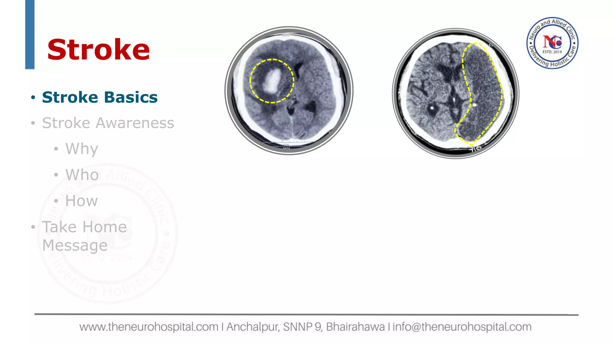 Community Stroke Awareness 2022 | PPTX | First Aid | Injuries