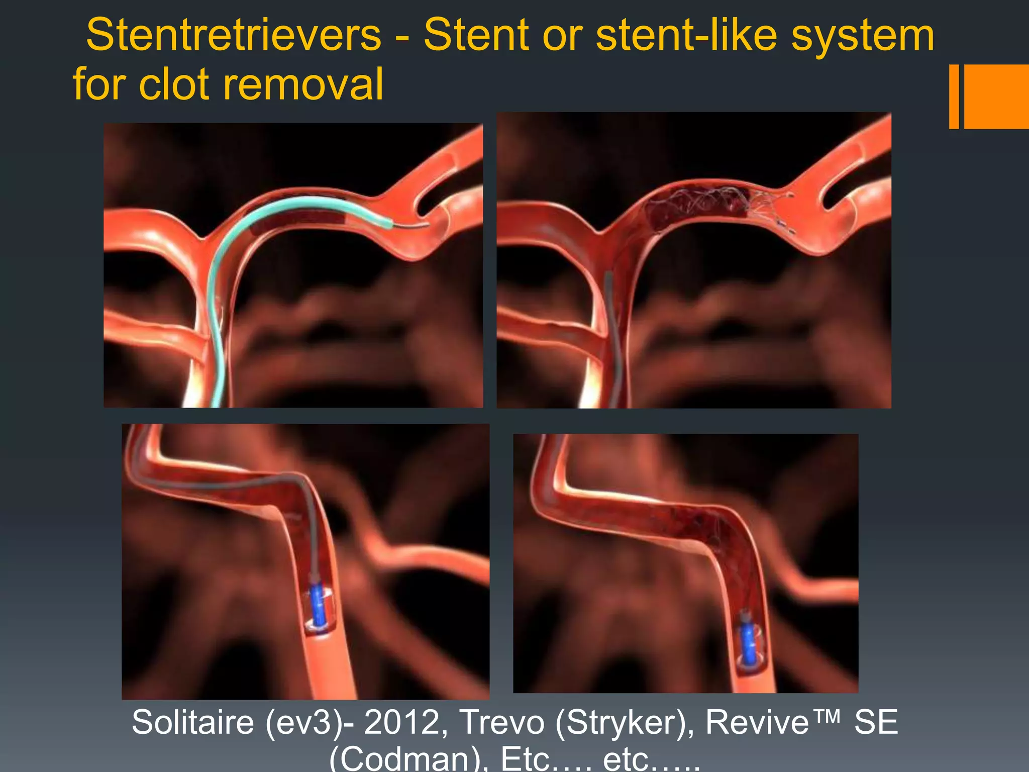 Stroke Awareness | PPTX