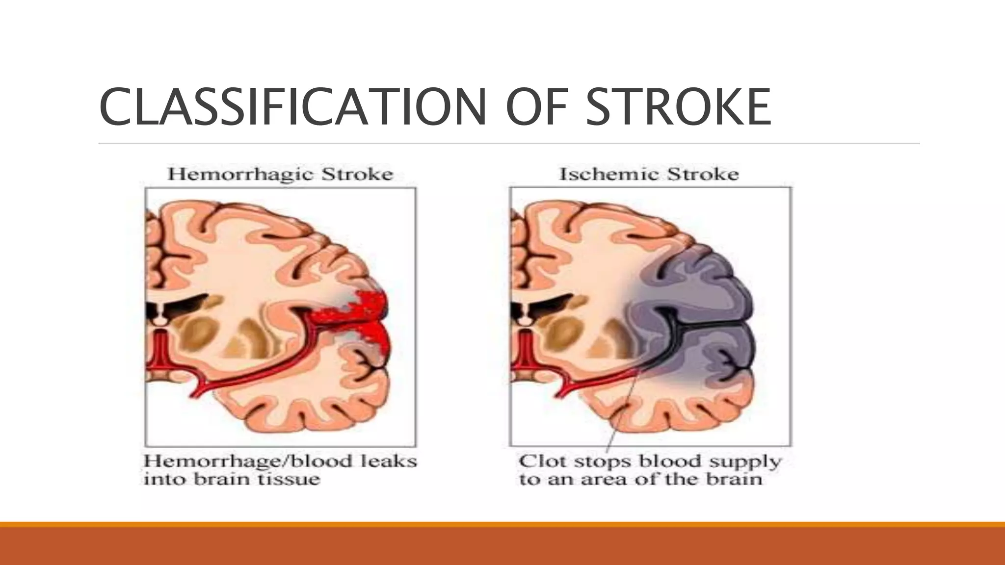 Stroke Pptx
