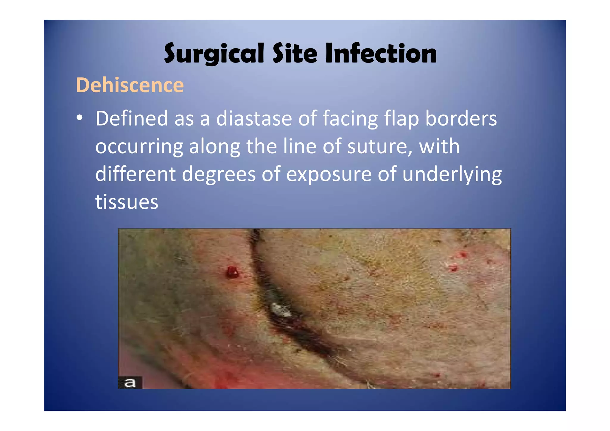 Stroke Care of Patient With Post Decompressive Craniectomy | PDF