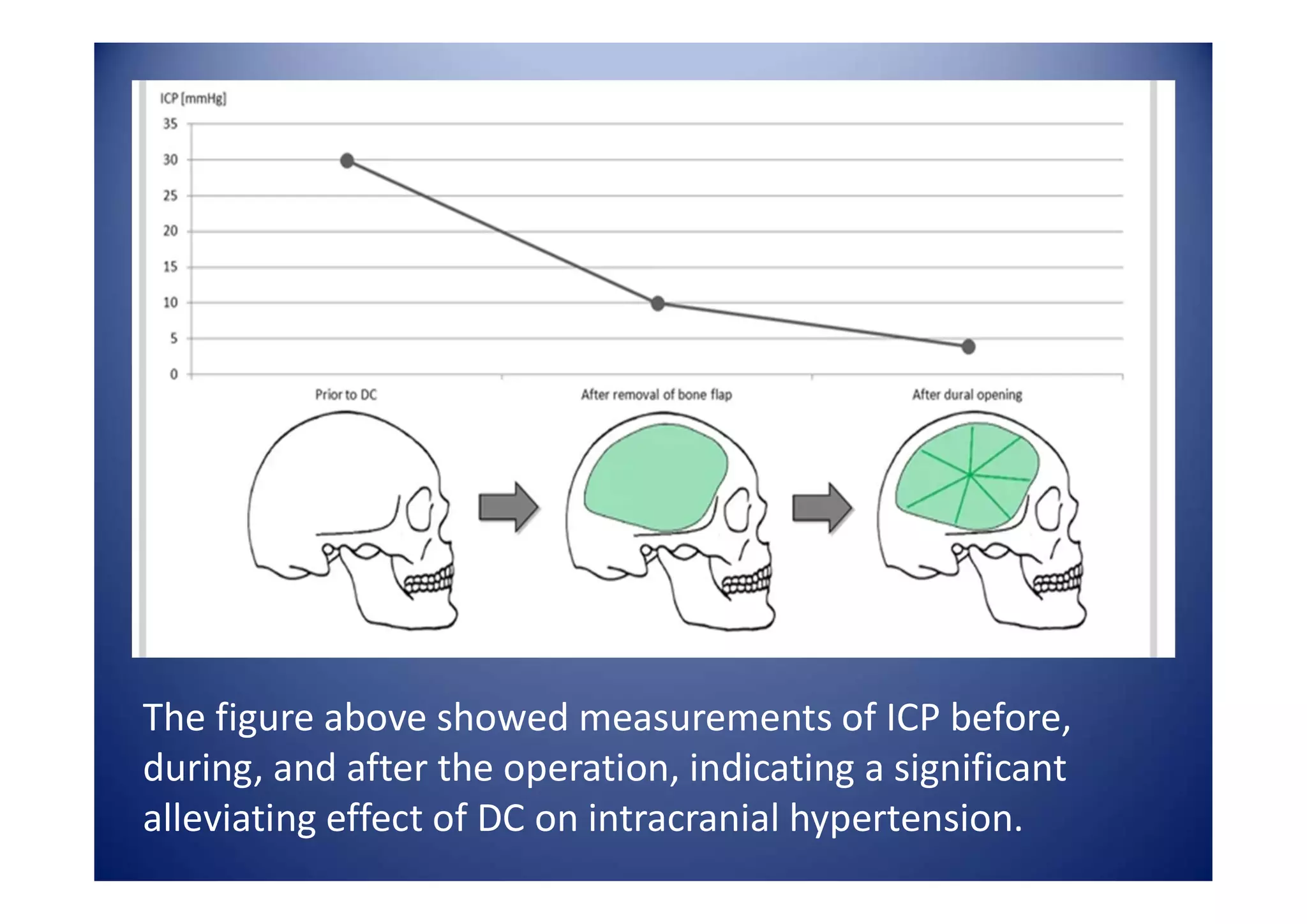 Stroke Care of Patient With Post Decompressive Craniectomy | PDF