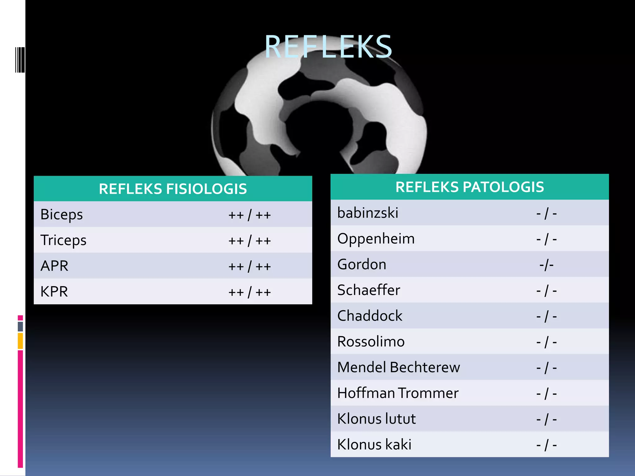 Stroke case Philjeuwbens | PPTX