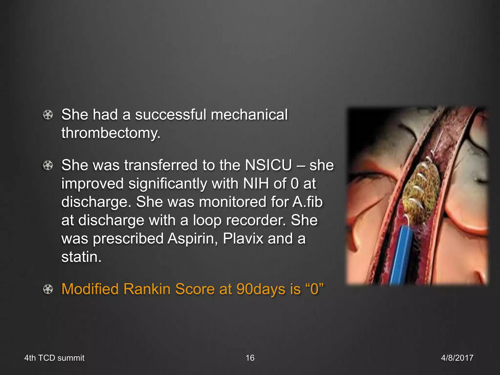 Acute Stroke management | PPTX