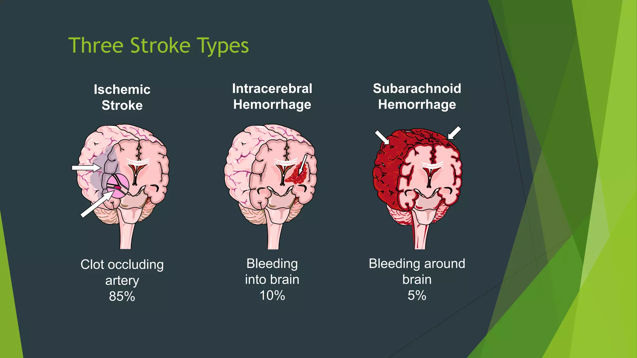Stroke class | PPTX