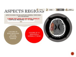 STROKE CODE CASE REPORT AND PROTOCOL.pptx