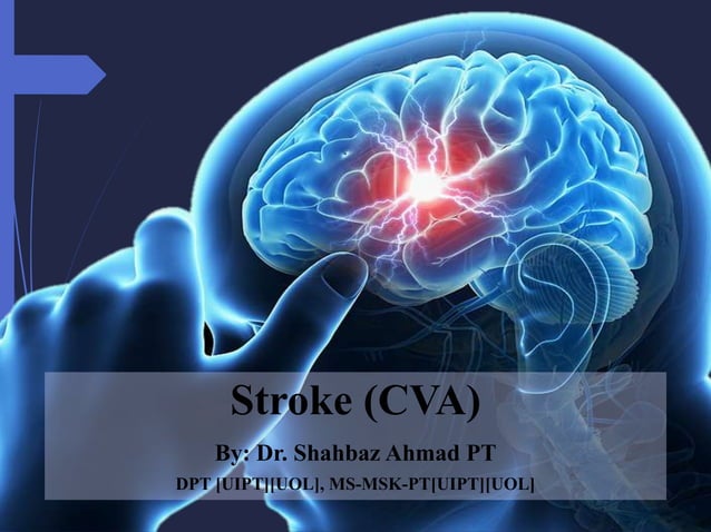 Stroke (cva) , CVA, Cerebrovascular Accident, Transient Ischemic Attack | PPT