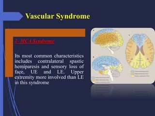 Stroke (cva) , CVA, Cerebrovascular Accident, Transient Ischemic Attack ...