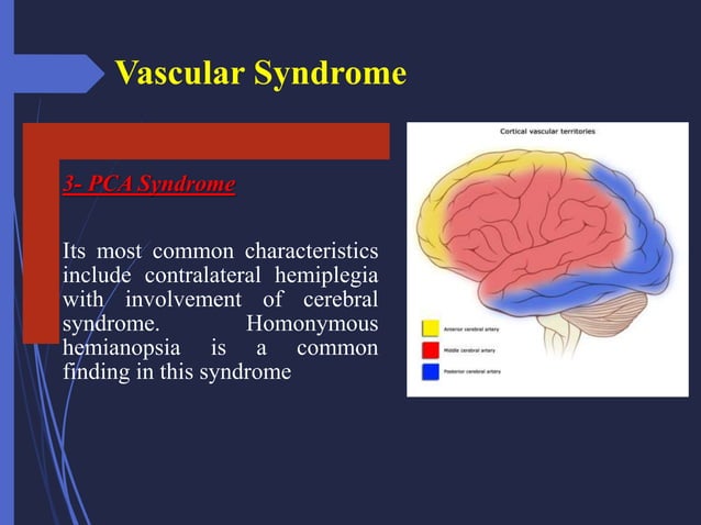 Stroke (cva) , CVA, Cerebrovascular Accident, Transient Ischemic Attack ...