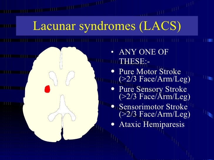 Stroke emergency treatment for 26th march 00