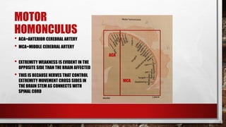 Stroke CEU | PPTX