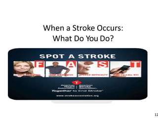CVA- Ischemic Stroke Case Study | PPTX