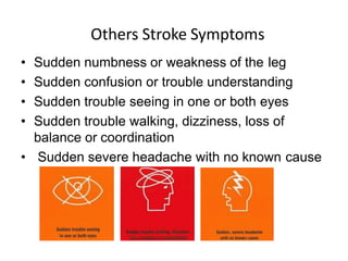 CVA- Ischemic Stroke Case Study | PPTX