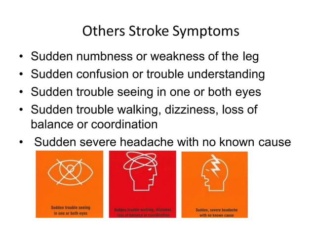 CVA- Ischemic Stroke Case Study | PPT