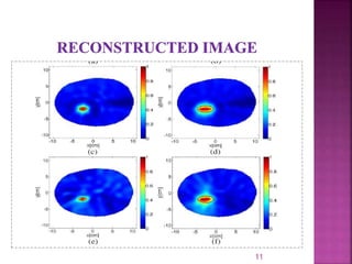 EARLY STROKE IDENTIFICATION USING MICROWAVE HELMET | PPT