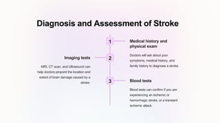 Stroke | PPTX