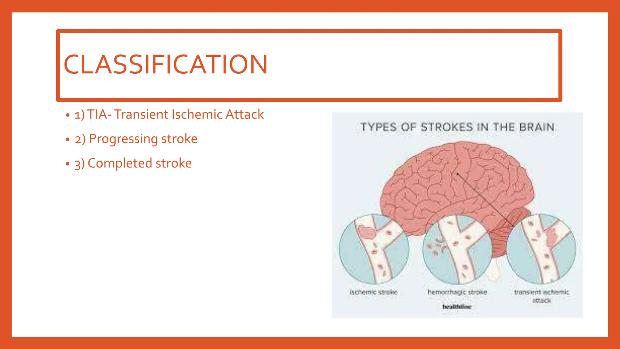 STROKE AND ITS TYPES - PATHOLOGY LECTURE | PPTX