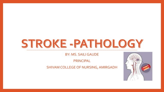 STROKE AND ITS TYPES - PATHOLOGY LECTURE | PPTX