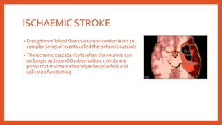 STROKE AND ITS TYPES - PATHOLOGY LECTURE | PPTX