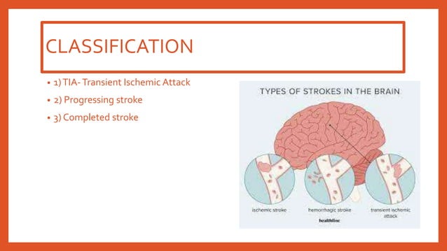 STROKE AND ITS TYPES - PATHOLOGY LECTURE | PPTX
