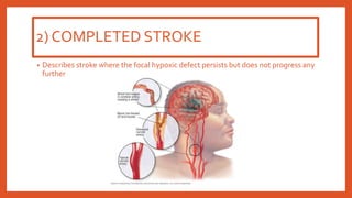 STROKE AND ITS TYPES - PATHOLOGY LECTURE | PPTX