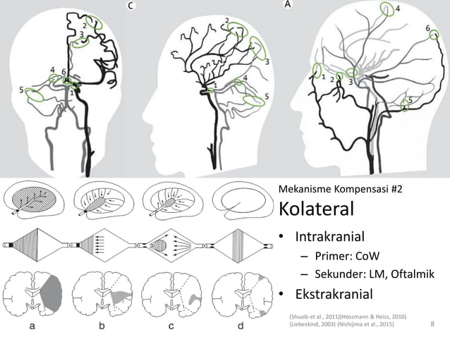 Stroke Hemodinamik | PDF