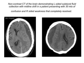 Stroke imaging | PPT
