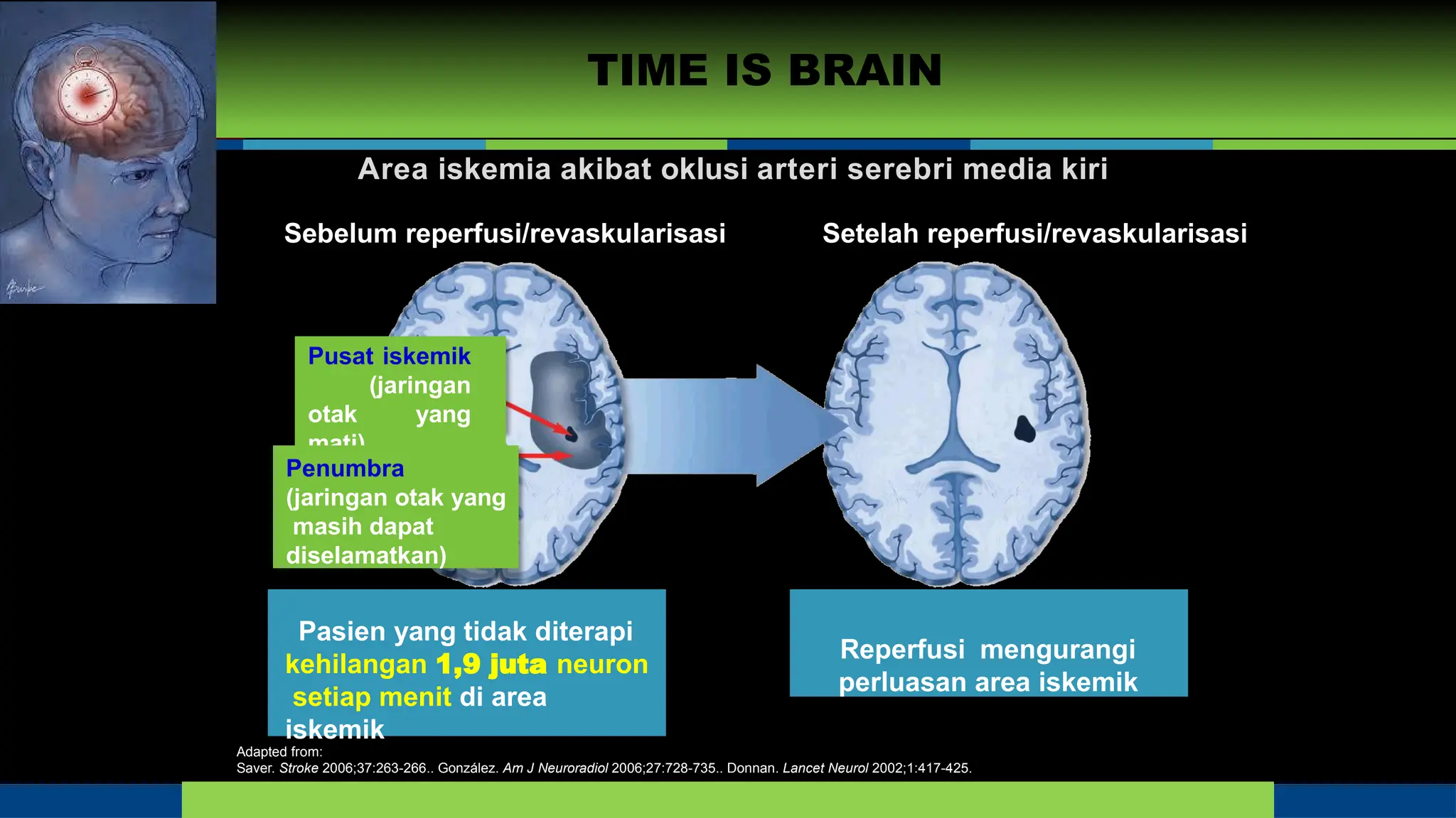 stroke infark, mengapa waktu penting.pptx