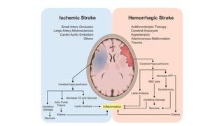 Stroke in Indonesia.pptx