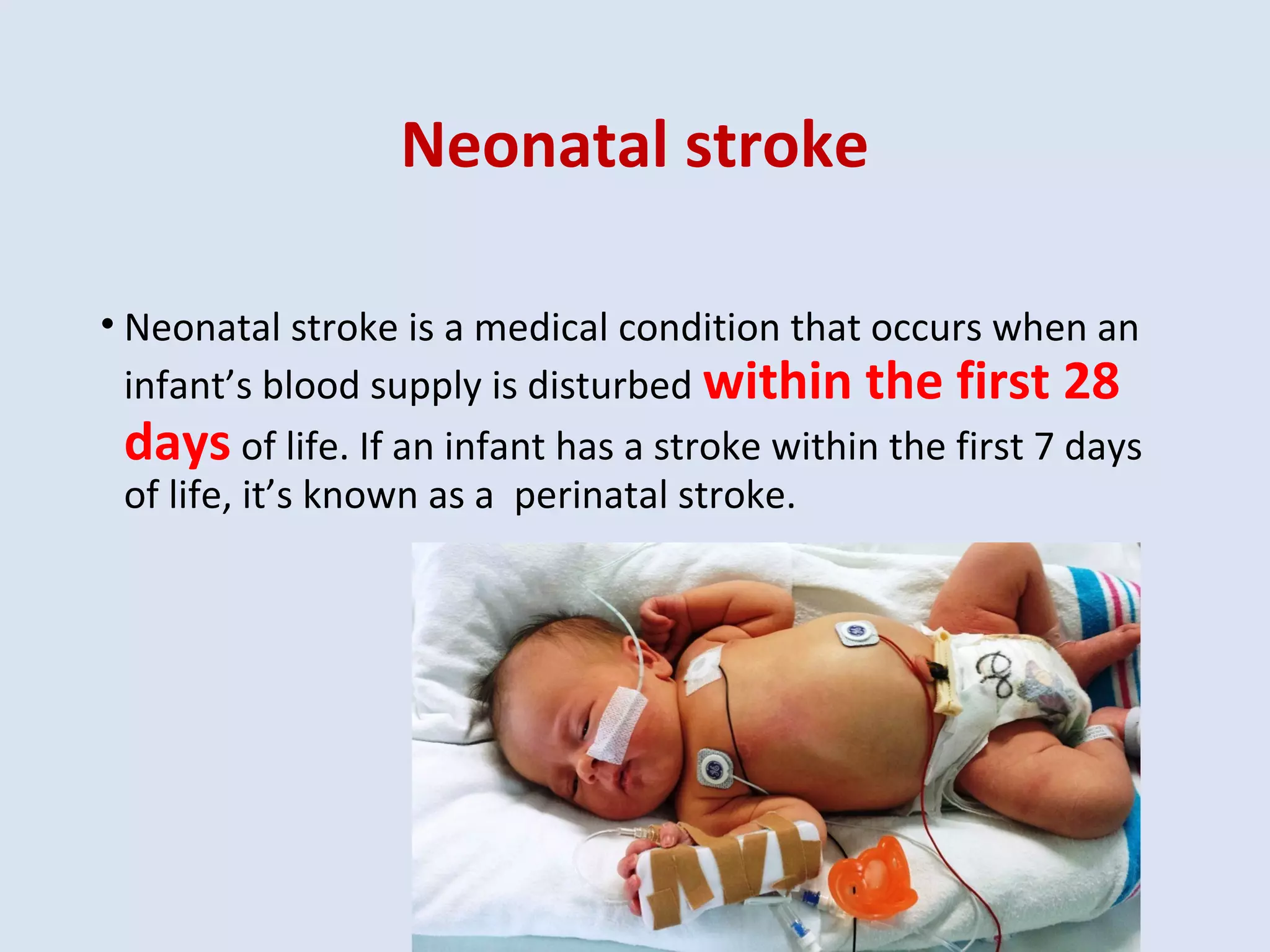 Stroke in infancy and childhood | PPT