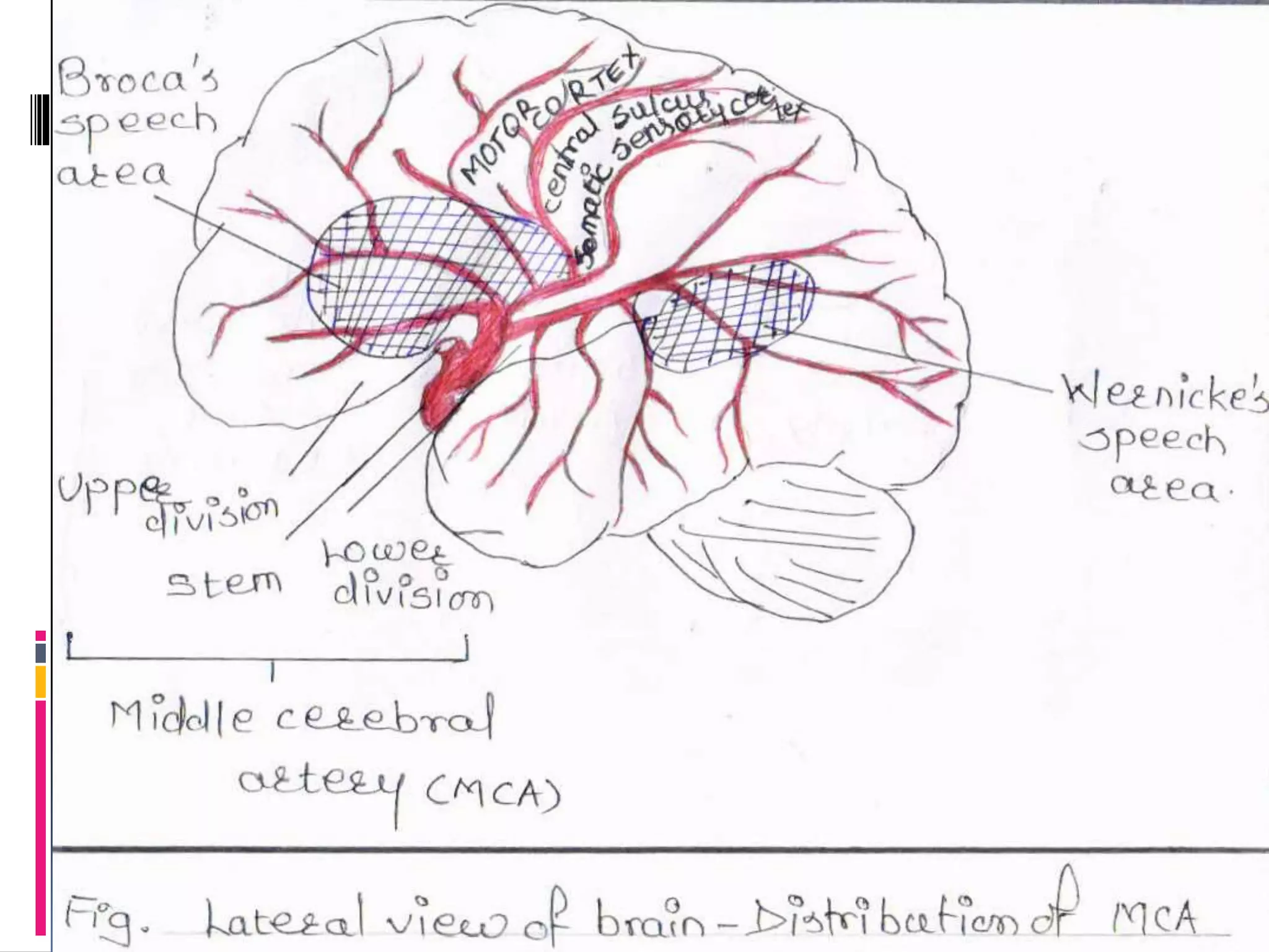 STROKE INTRODUCTION, CLASSIFICATION AND CLINICAL FEATURES.pptx