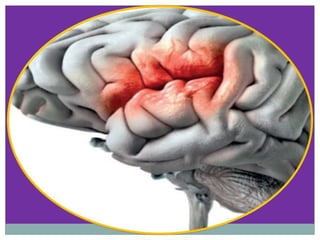 Stroke is preventable and curable | PPTX