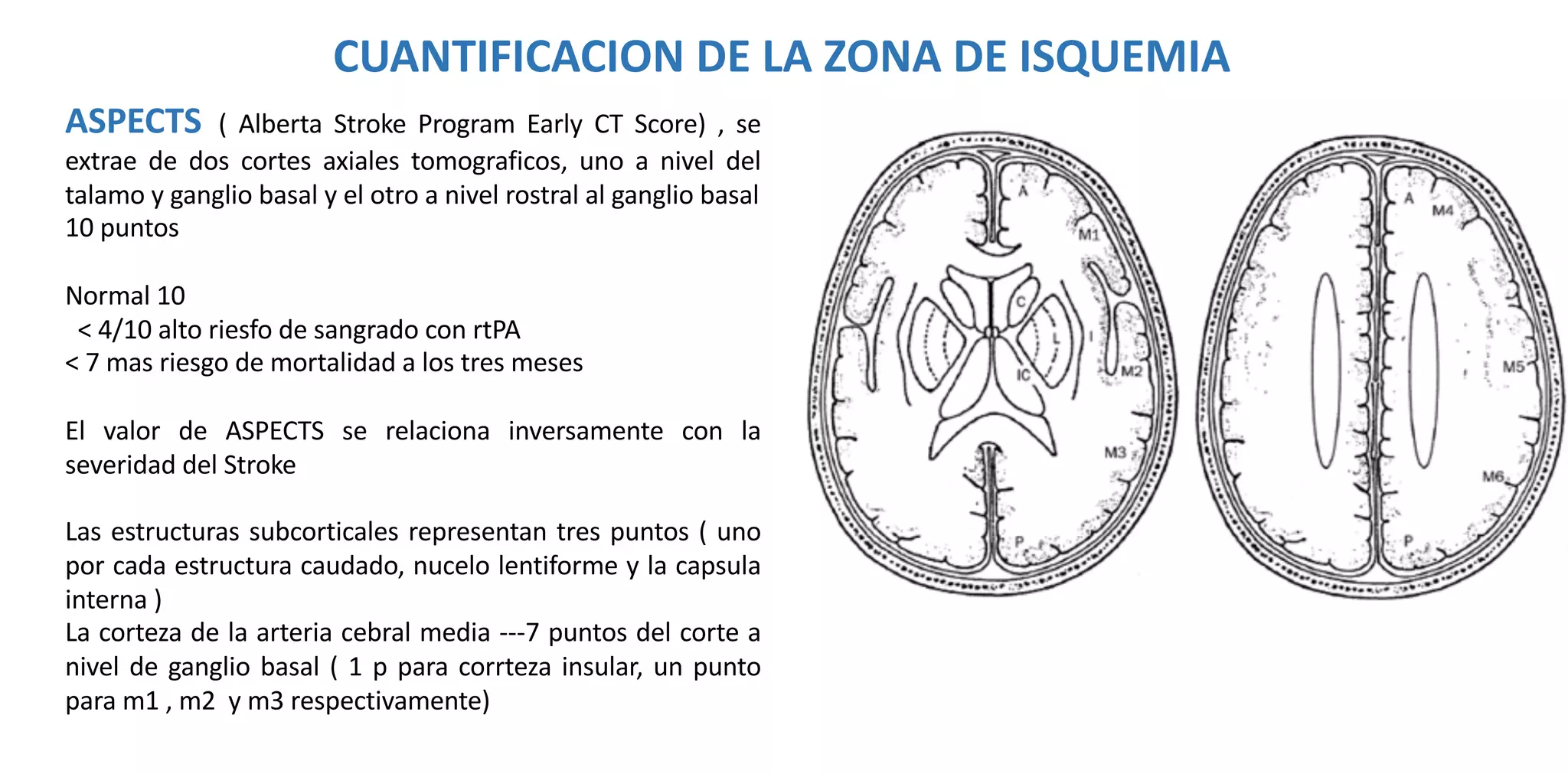 STROKE ENFERMEDAD CEREBROVASCULAR | PDF