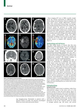 Stroke lancet 2020 | PDF