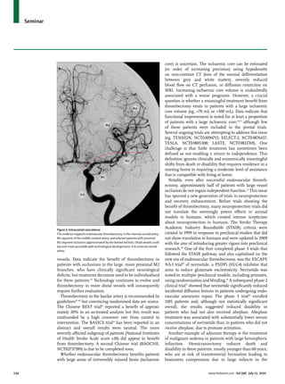 Stroke lancet 2020 | PDF