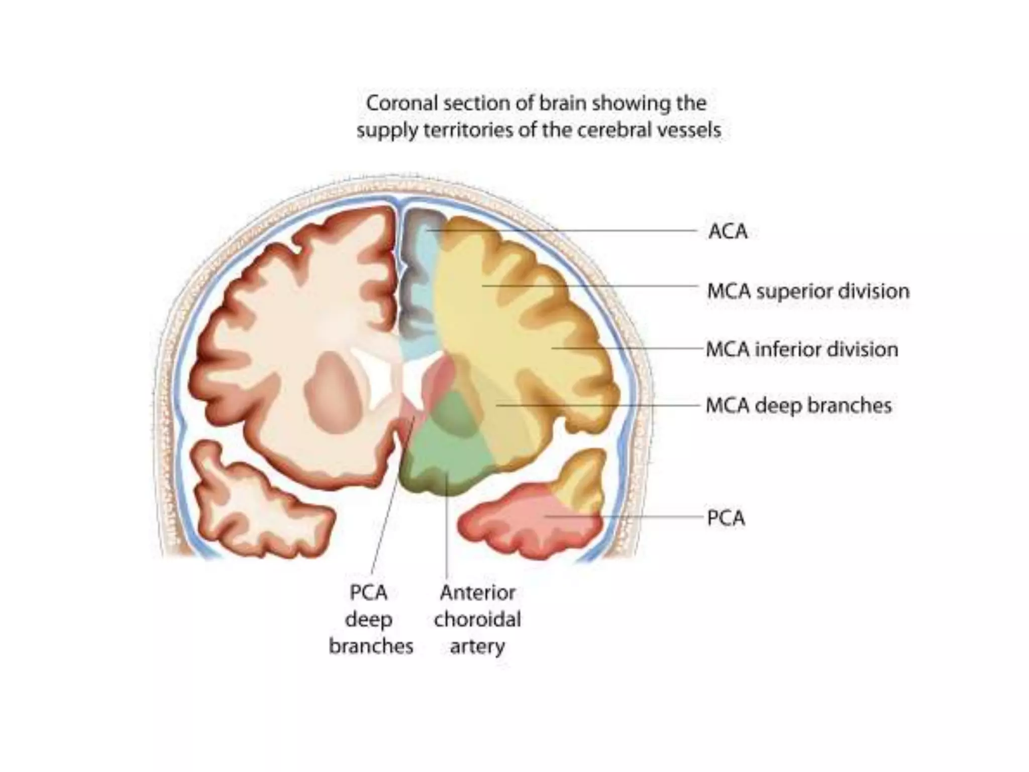 Stroke localization | PPTX