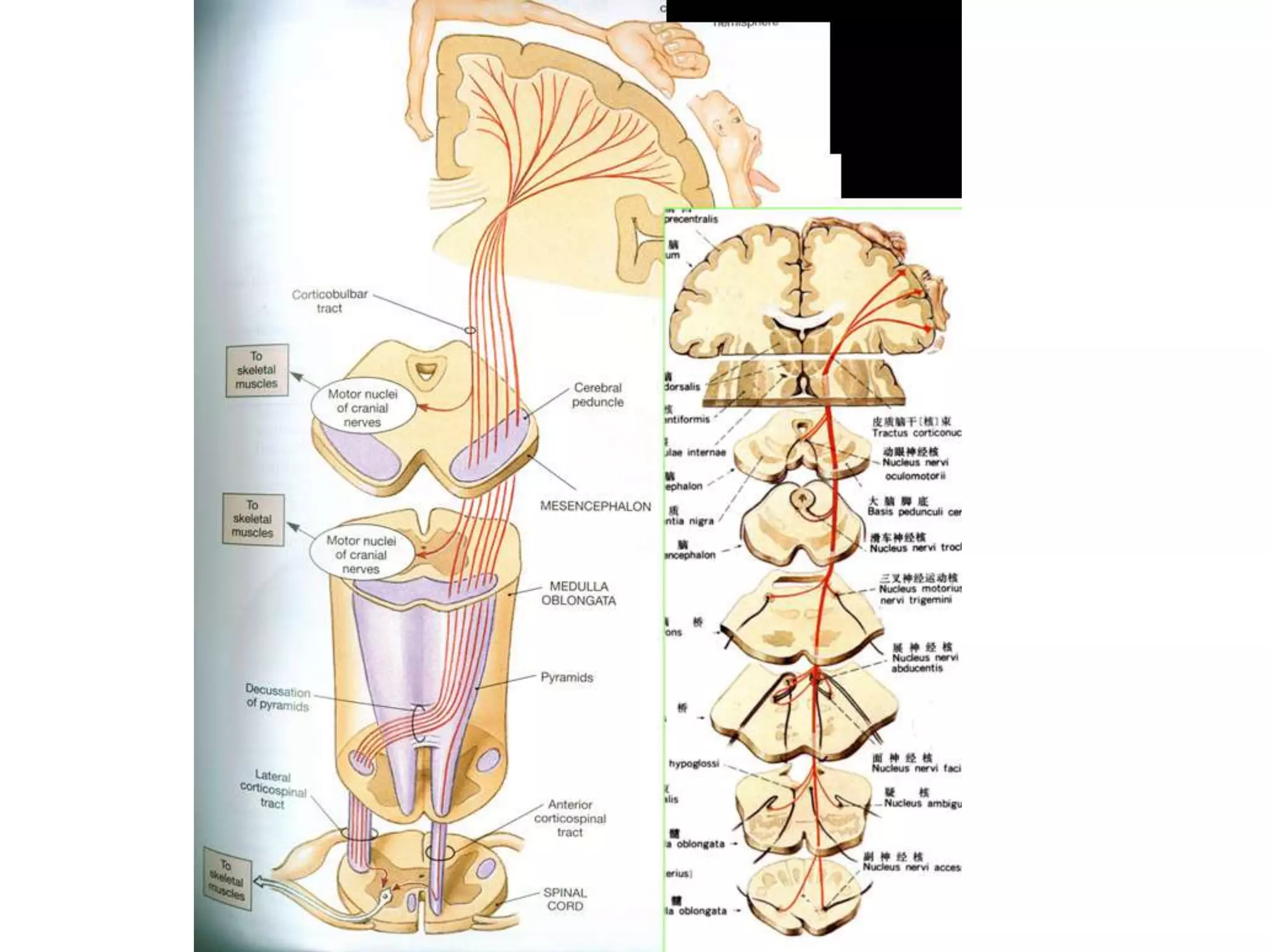 Stroke localization | PPTX