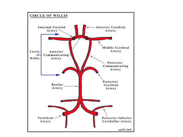 Stroke localization | PPTX | Blood Disorders | Diseases and Conditions