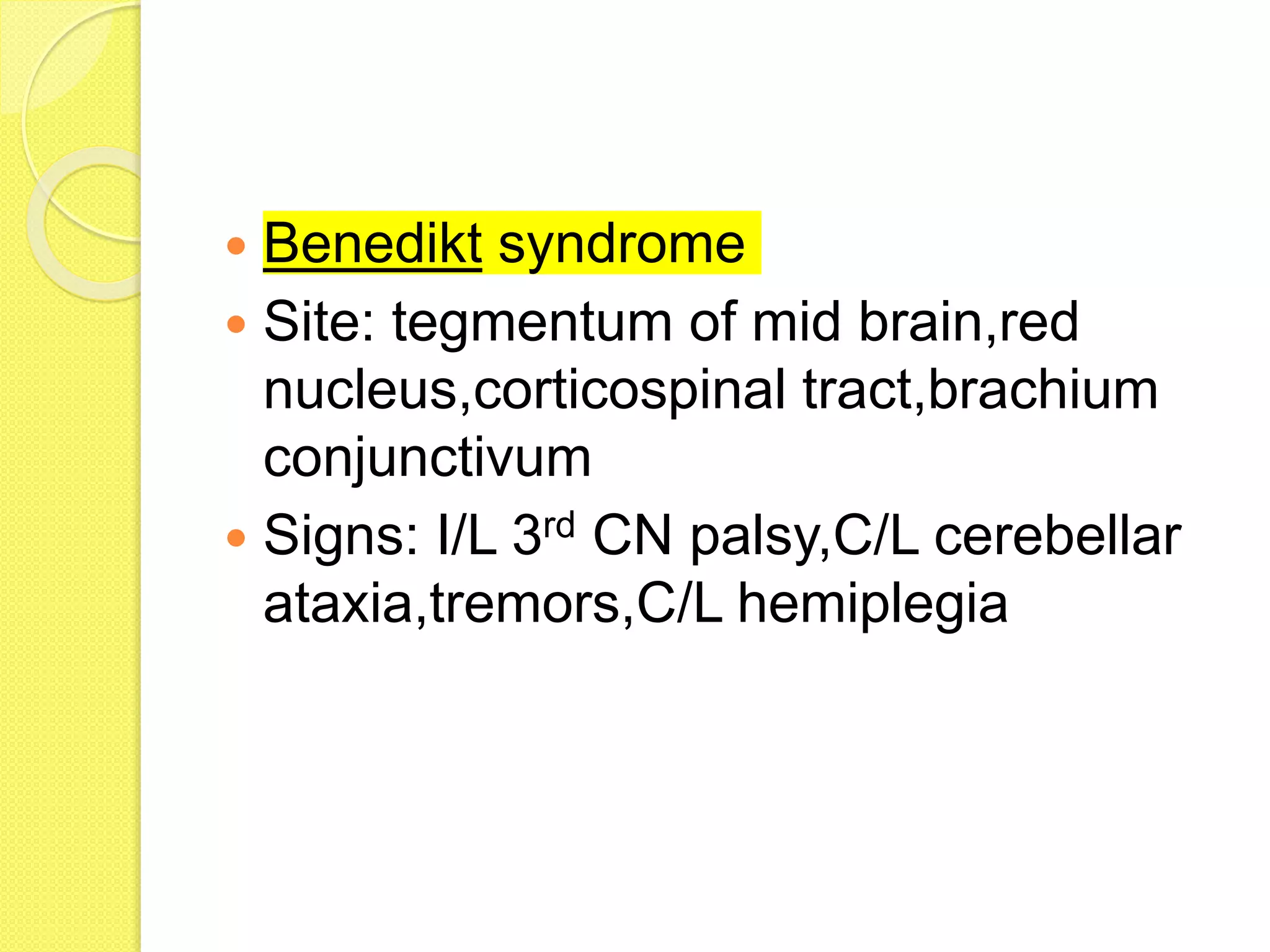 Stroke localization by Dr. Md. firoz | PPTX