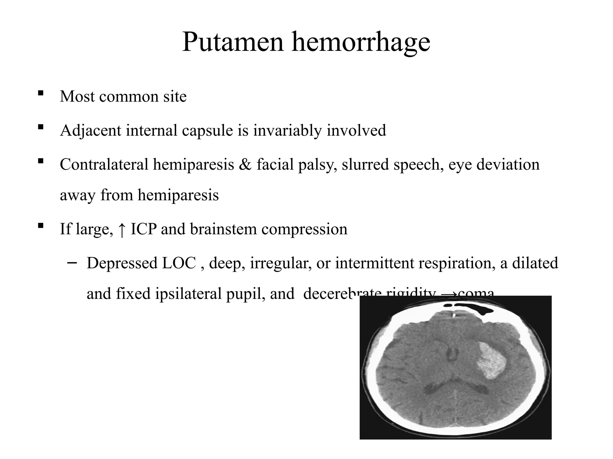 Stroke medina........................pptx