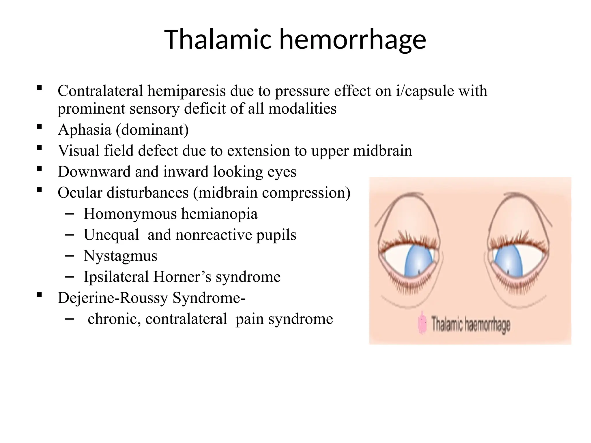 Stroke medina........................pptx