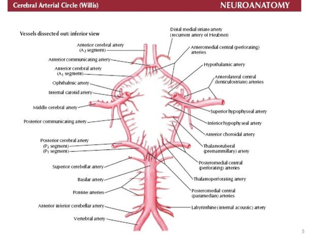 Stroke medina........................pptx