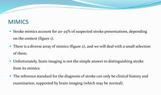 Stroke mimics | PPTX