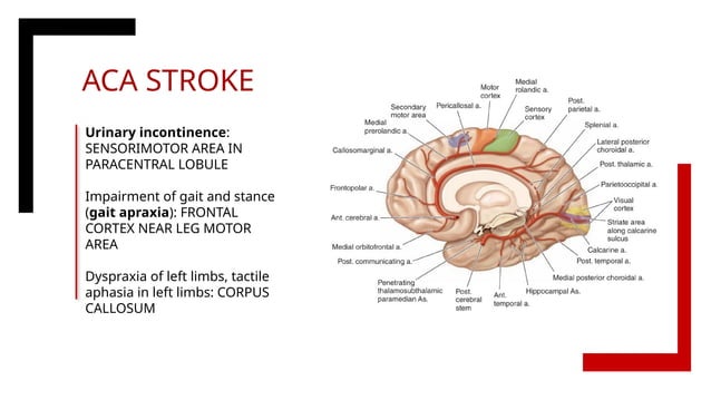 Stroke (Natural History, Progression).pptx
