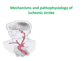 Stroke patho physiology | PPTX
