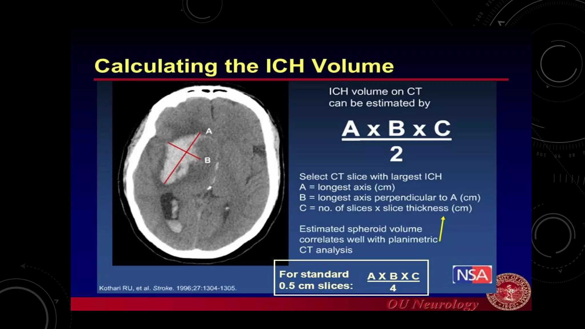 Stroke Perdarahan (Hemorhagik) | PPTX