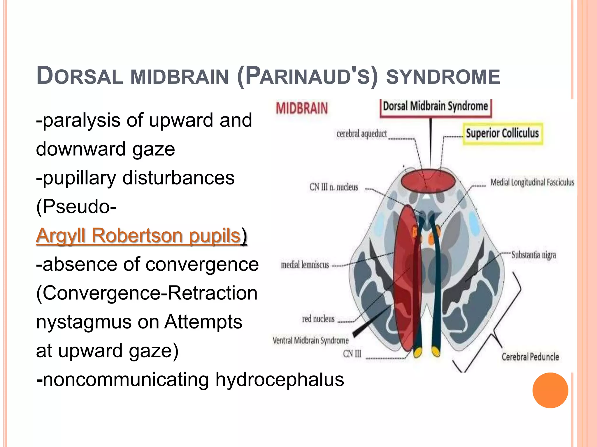 Stroke ppt | PPTX