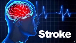 Stroke ppt | PPT