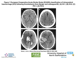 Acute Stroke management presentation ppt | PPT | First Aid | Injuries